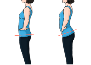 What is Muscular Hyperlordosis and could massage help? | Holland ...
